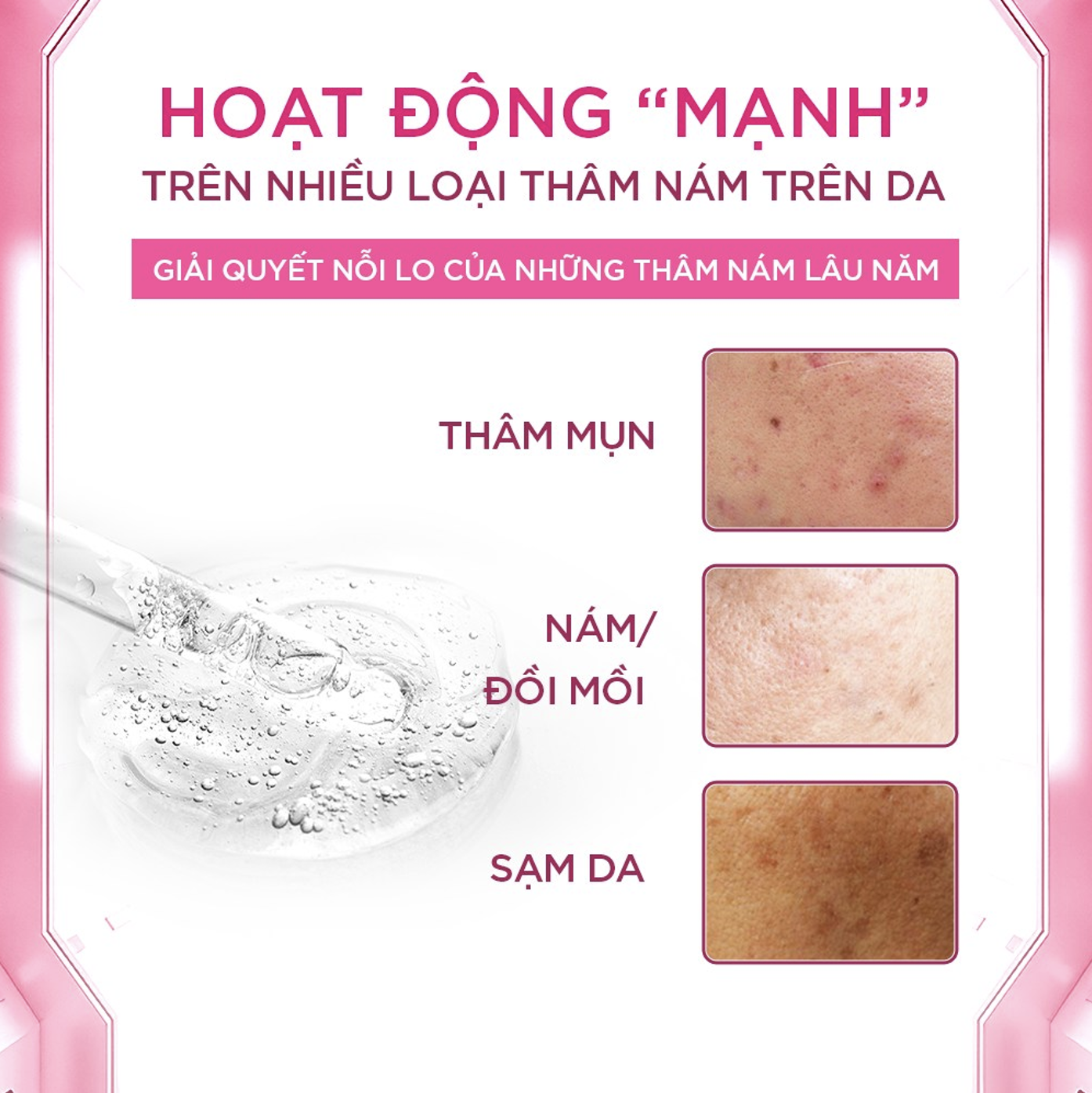 Hướng dẫn sử dụng serum trị nám PageOne Tranacide Pro + Exosome hiệu ...
