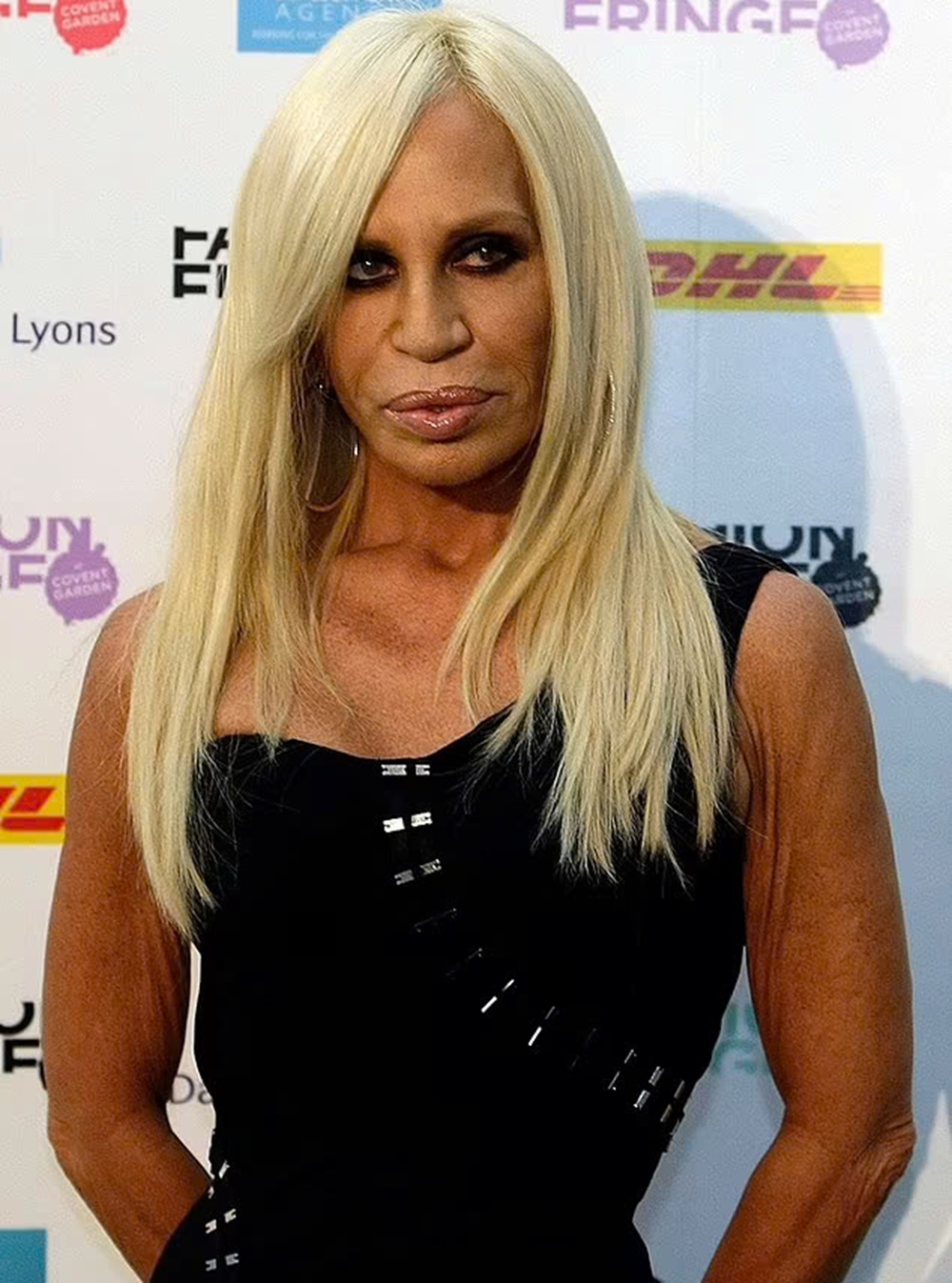 Donatella Versace và cuộc 'cách mạng' nhan sắc lớn nhất từ trước đến nay