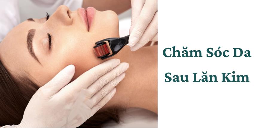 Chăm sóc da sau lăn kim như thế nào đúng cách?