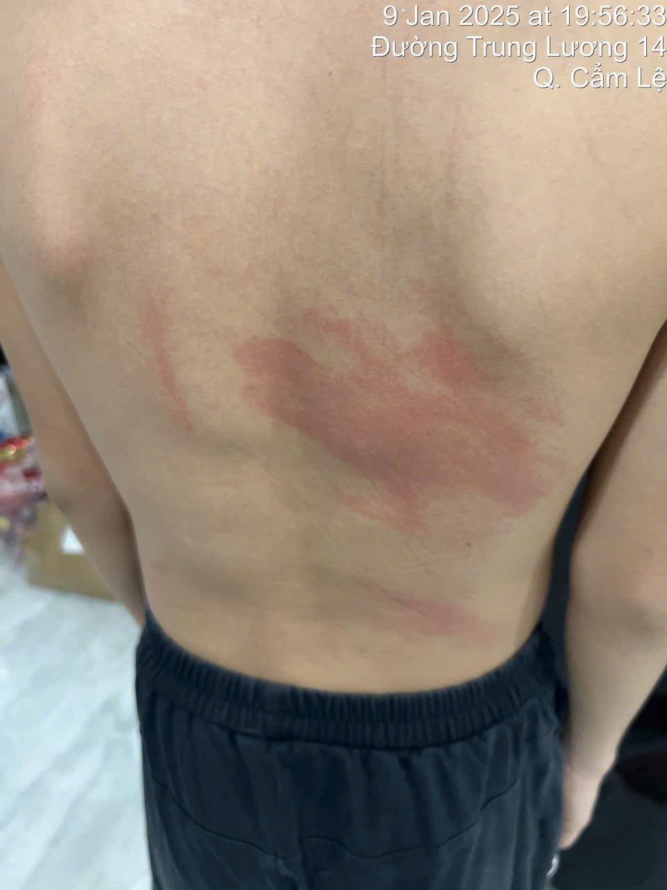 Liên đoàn Taekwondo Việt Nam vào cuộc vụ phụ huynh tố con bị HLV đánh ...