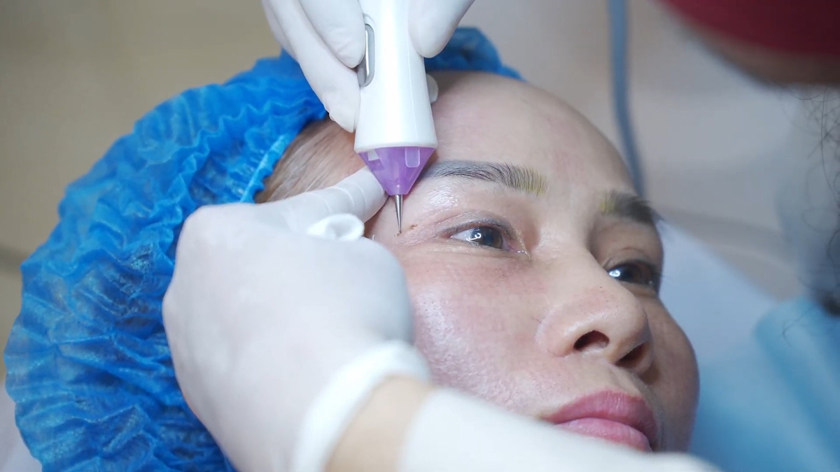 Plasma Gold: Công nghệ tiên phong trong thẩm mỹ, nội khoa hiện đại