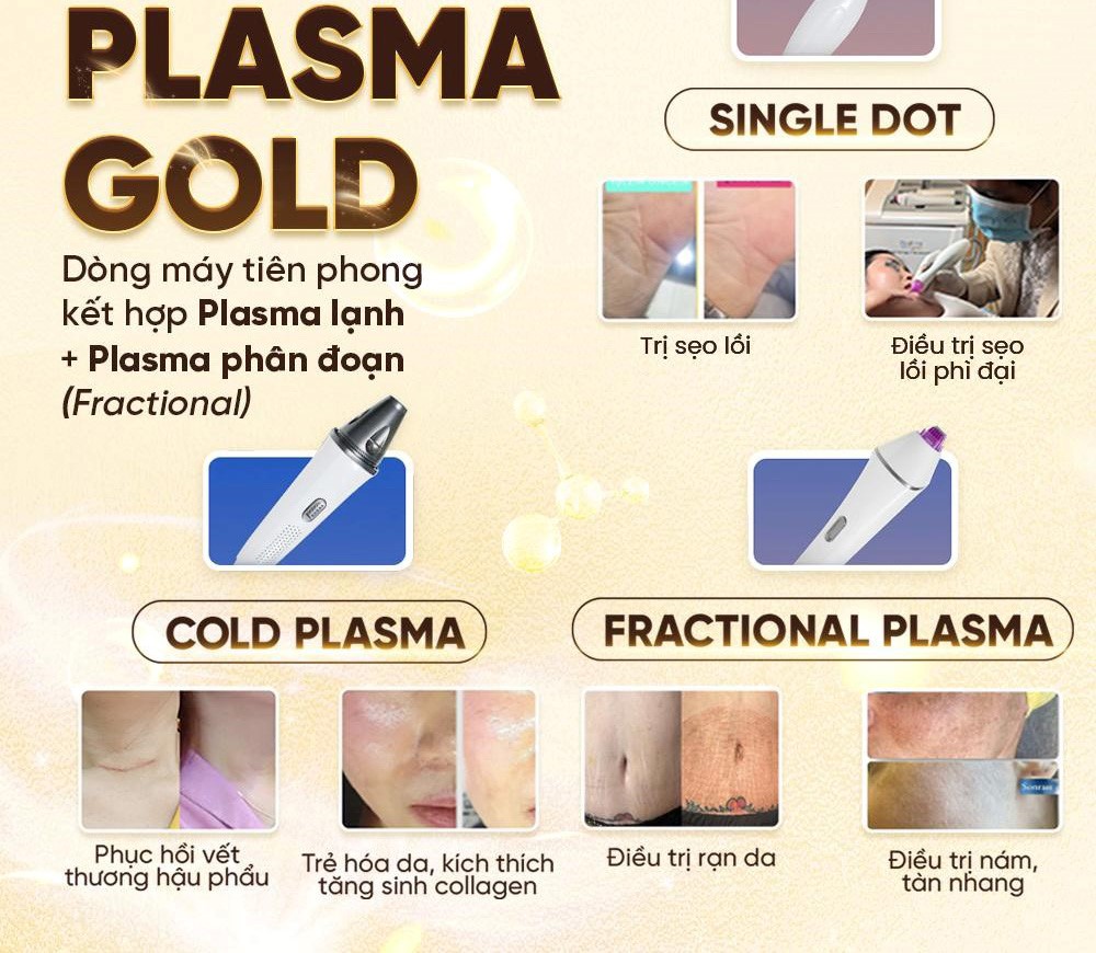 Máy Plasma Gold có tốt không? Giá 1 liệu trình là bao nhiêu?