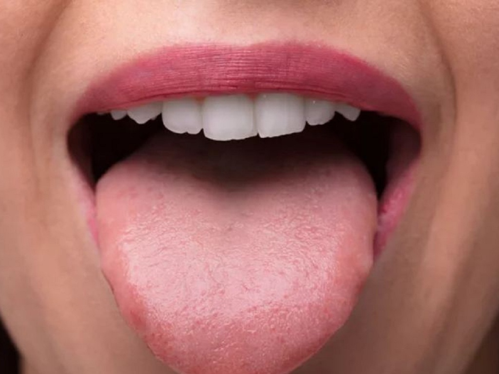 Điều Gì đang Xảy Ra Với Cơ Thể Khi Lưỡi Bỗng Dưng Tái Nhợt