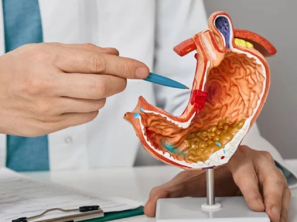 Phải làm gì khi bị xuất huyết dạ dày do vết loét?