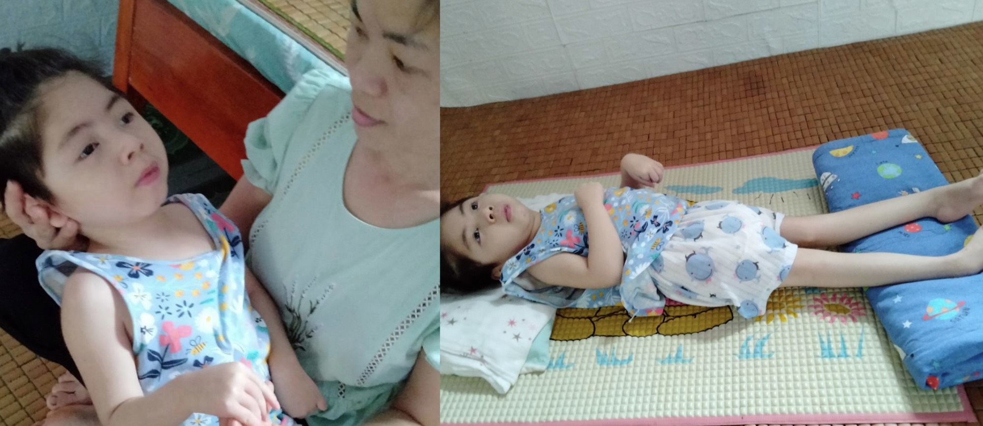 Mẹ côi cút làm thuê kiếm 2 triệu/tháng nuôi con gái tật nguyền