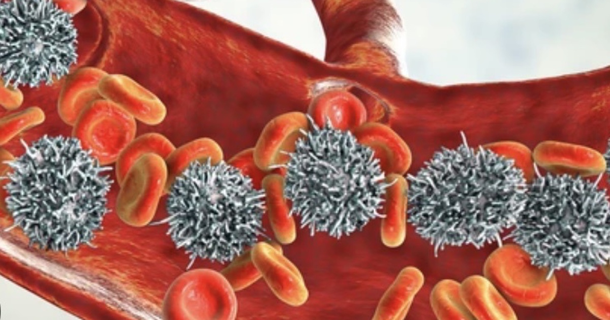 Đổ mồ hôi ban đêm: Khi nào thì đáng lo?