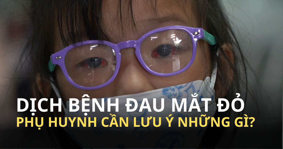 Dịch đau mắt đỏ dễ lây lan trong trường học, phụ huynh cần lưu ý gì?