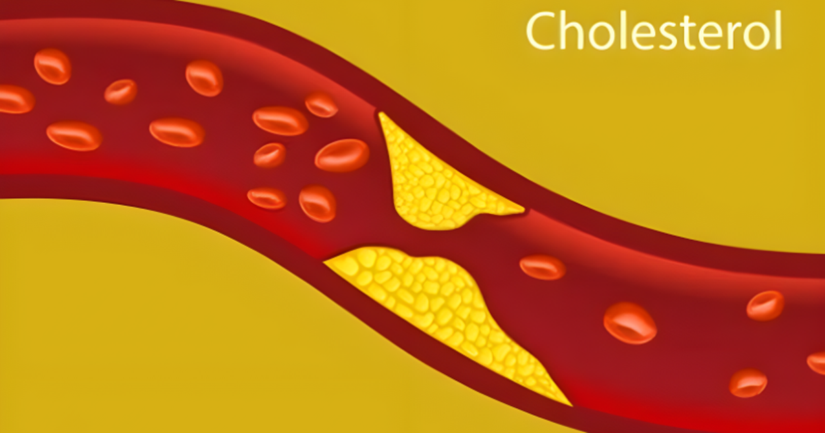 Ngày mới với tin tức sức khỏe: Ăn uống thế nào để mức cholesterol không ...