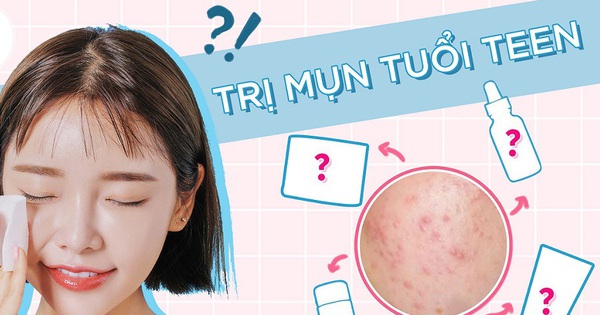 Top 10 kem trị mụn cho tuổi dậy thì hiệu quả, an toàn, không gây kích ứng